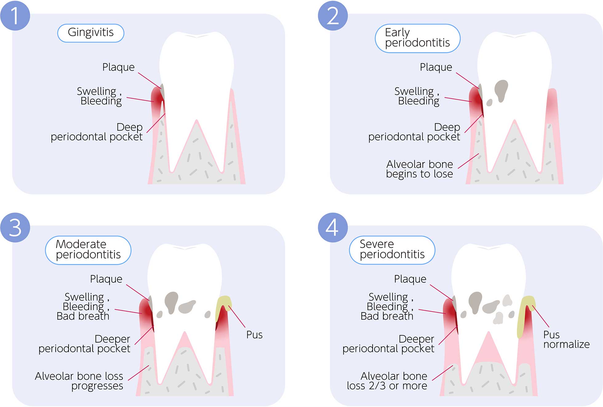 Gums‚ swelling, bleeding & receding gums, Midtown New York